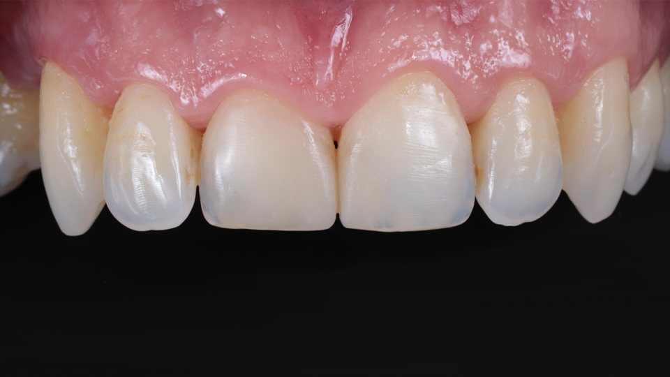 Venus® Pearl Pure Shades