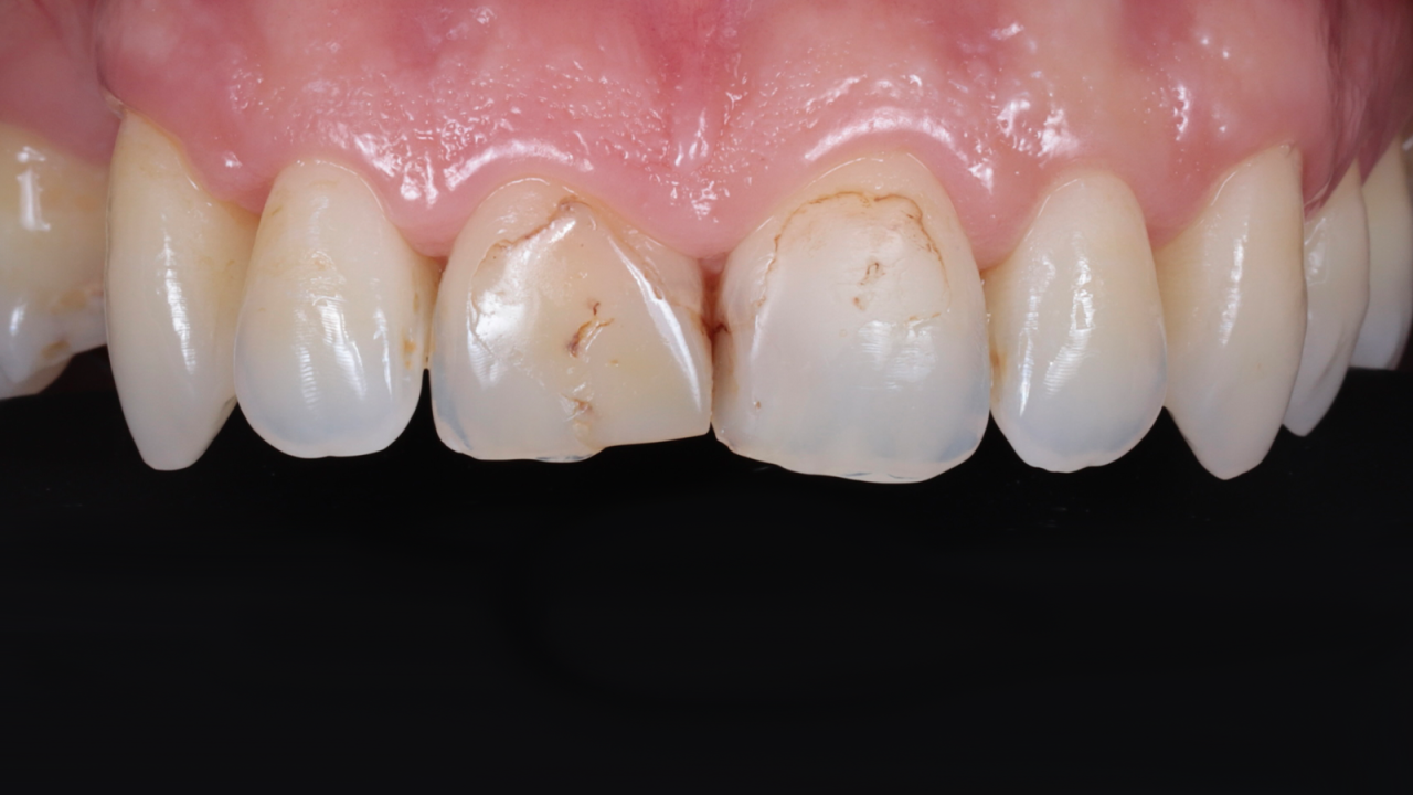 Venus® Pearl Pure Shades